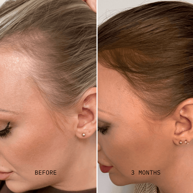 Advanced Hair Formula | Hair Growth Supplements – Hairburst